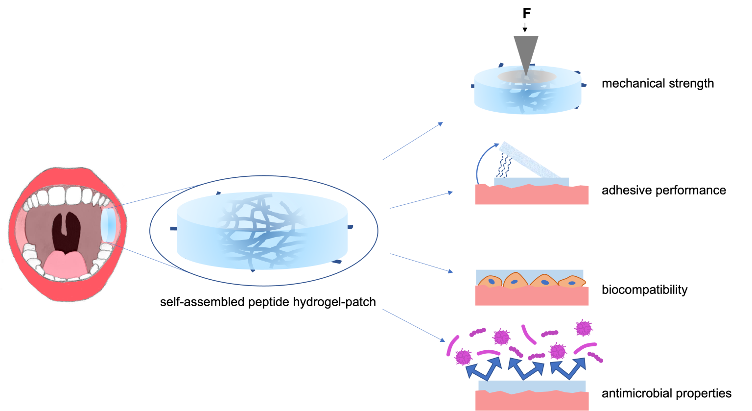 Therapy to treat ulcers in the oral mucosa – Hydrogel Patch Project ...