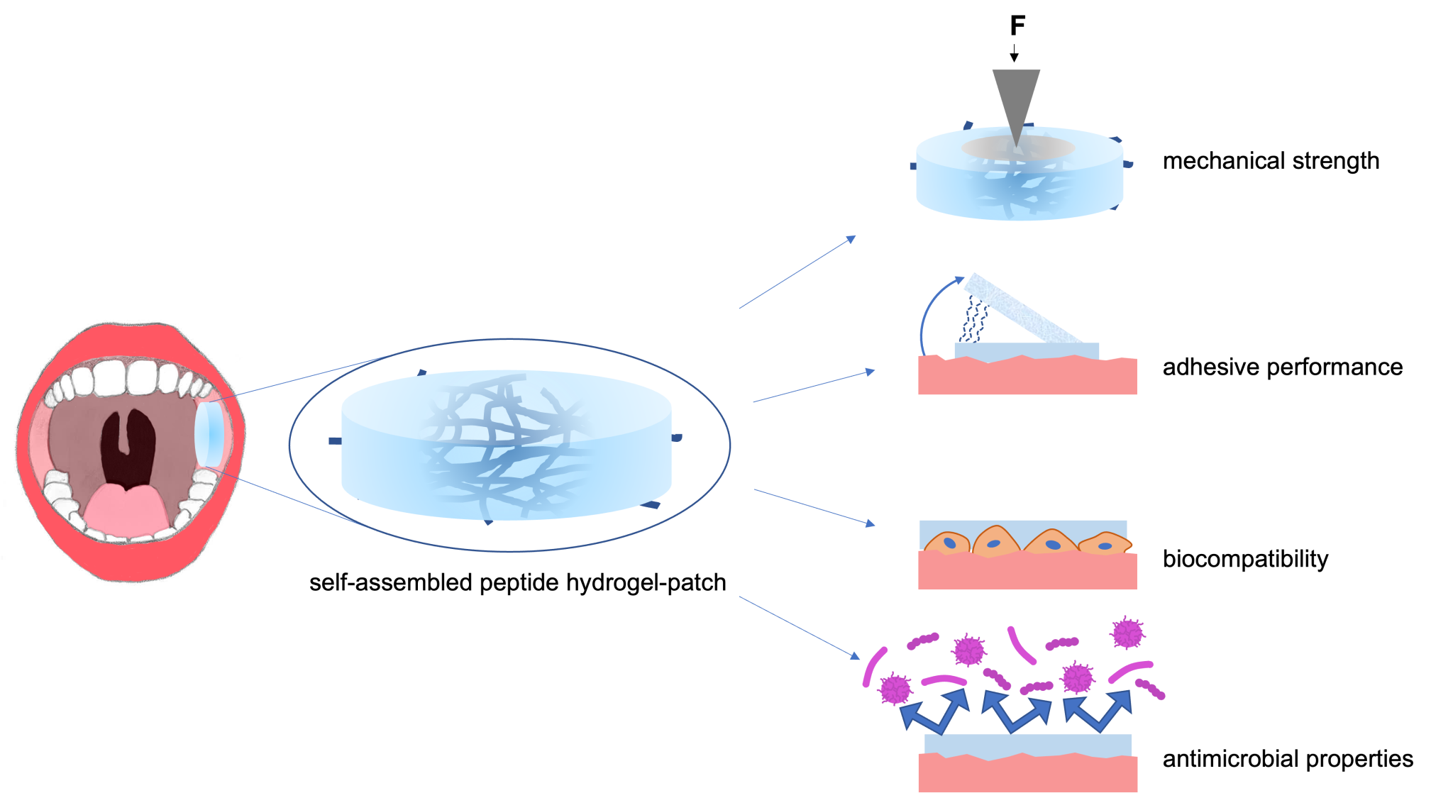 Therapy to treat ulcers in the oral mucosa – Hydrogel Patch Project ...