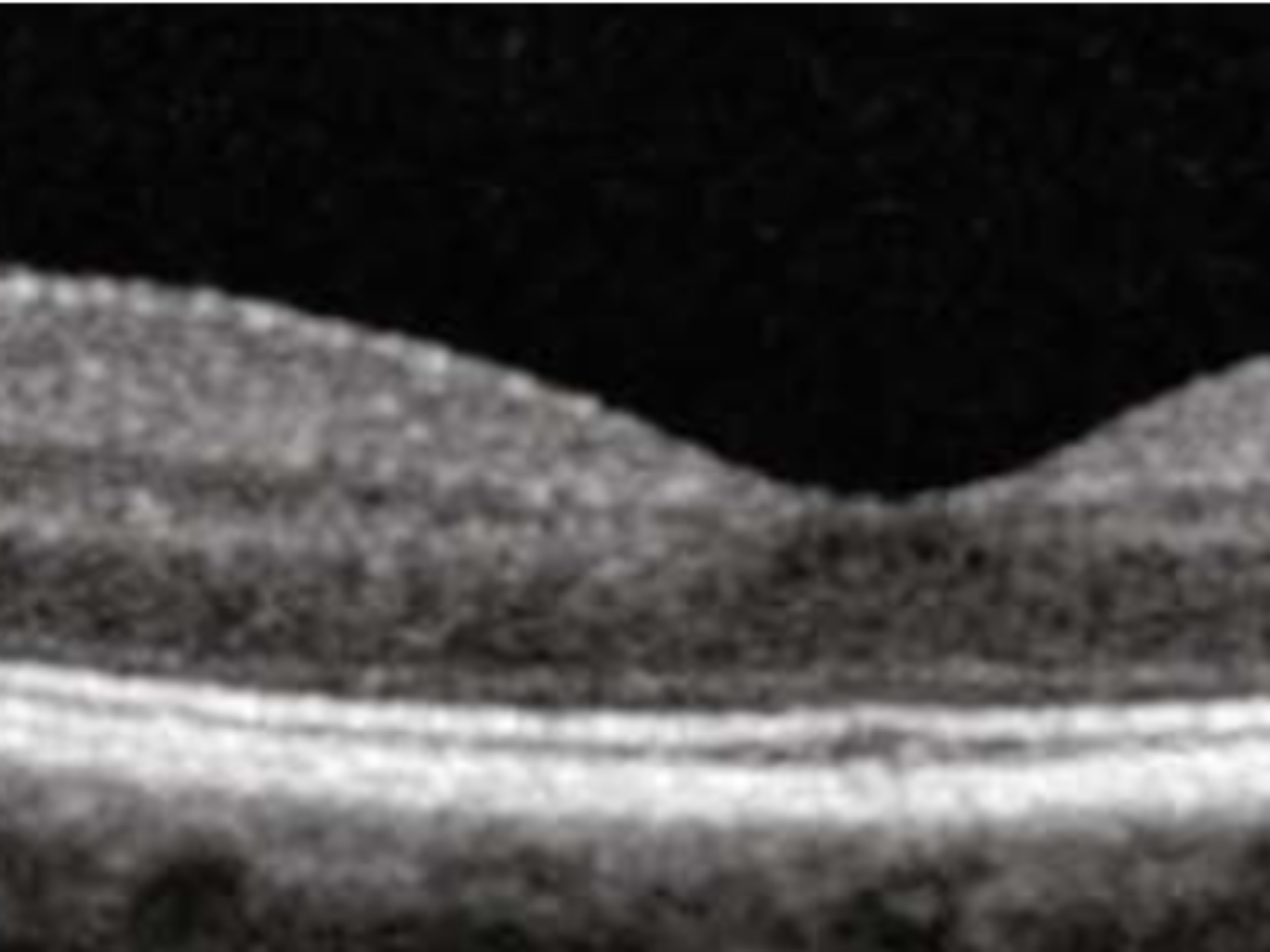 Optometrische Dienstleistungen - Optometrische Augenklinik